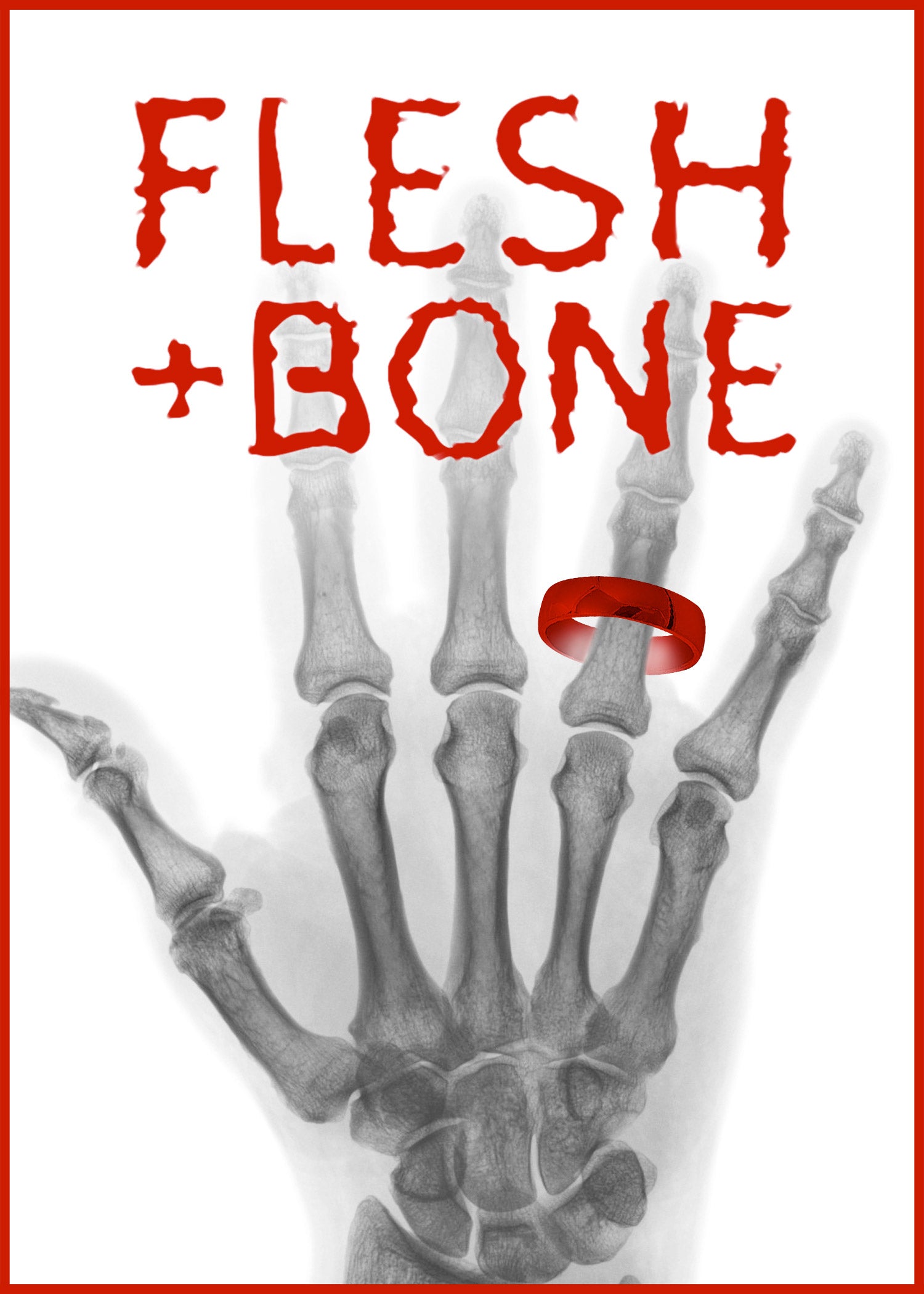 FLESH AND BONE